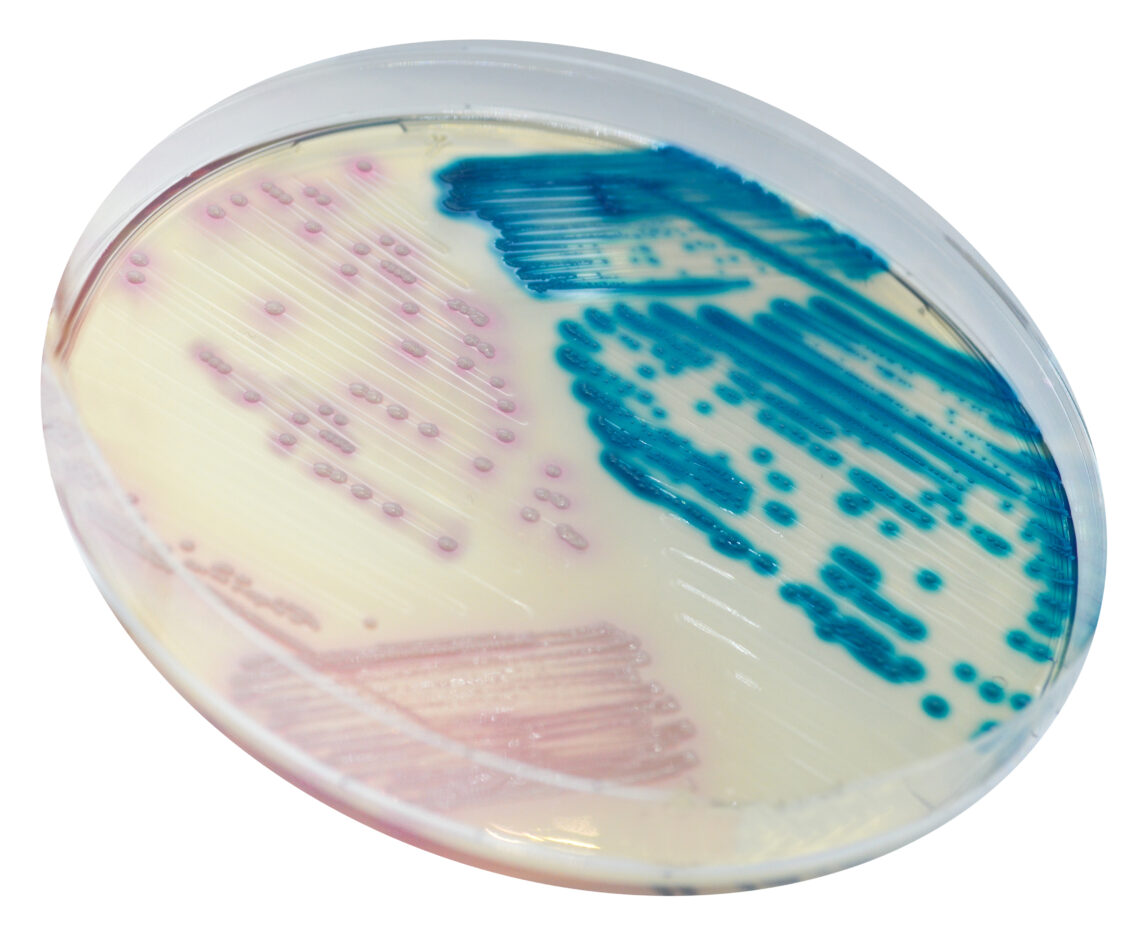 CHROMagar™ LIN-R - Chromagar