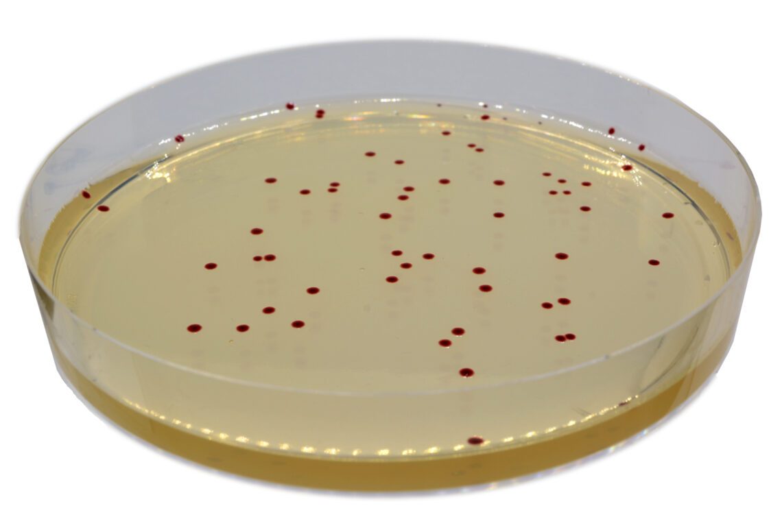 CHROMagar™ Campylobacter - Chromagar