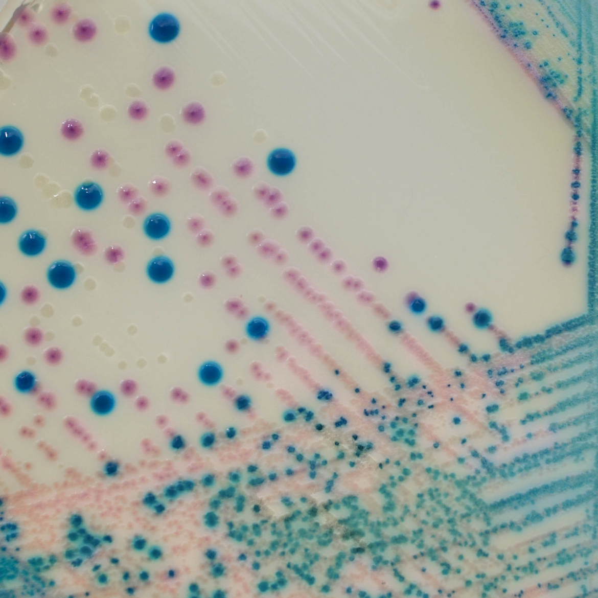 CHROMagar™ KPC - Chromagar