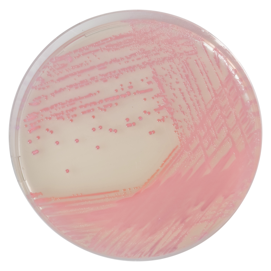 CHROMagar™ MRSA – Chromagar