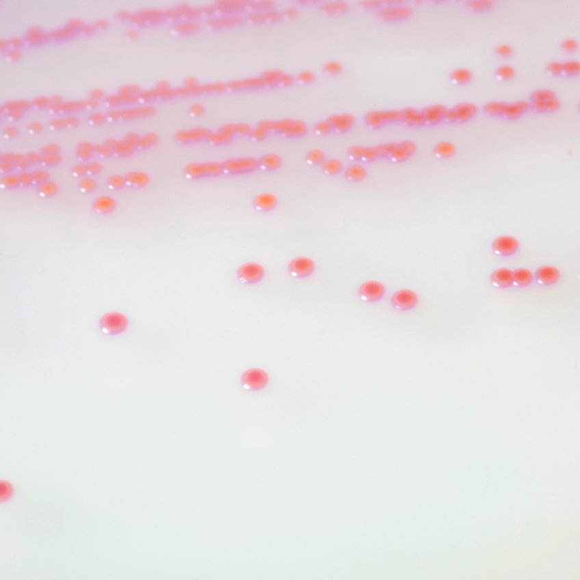 CHROMagar™ MRSA – Chromagar