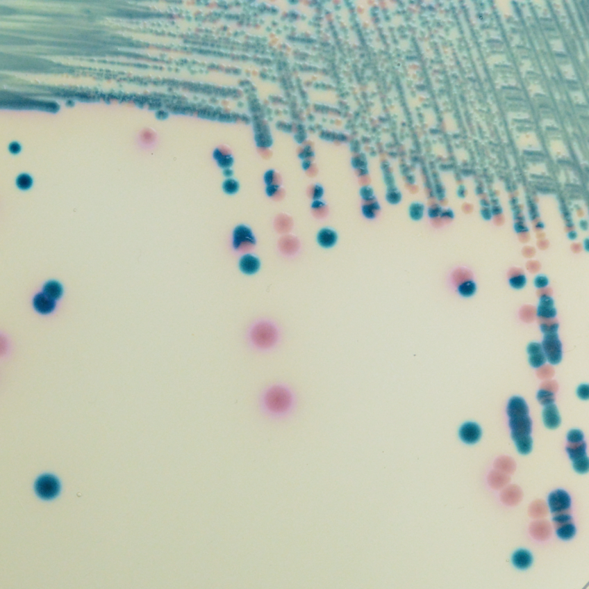 CHROMagar™ mSuperCARBA™ - Chromagar