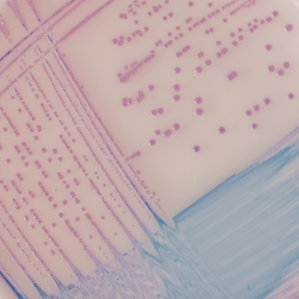 CHROMagar™ Salmonella - Chromagar