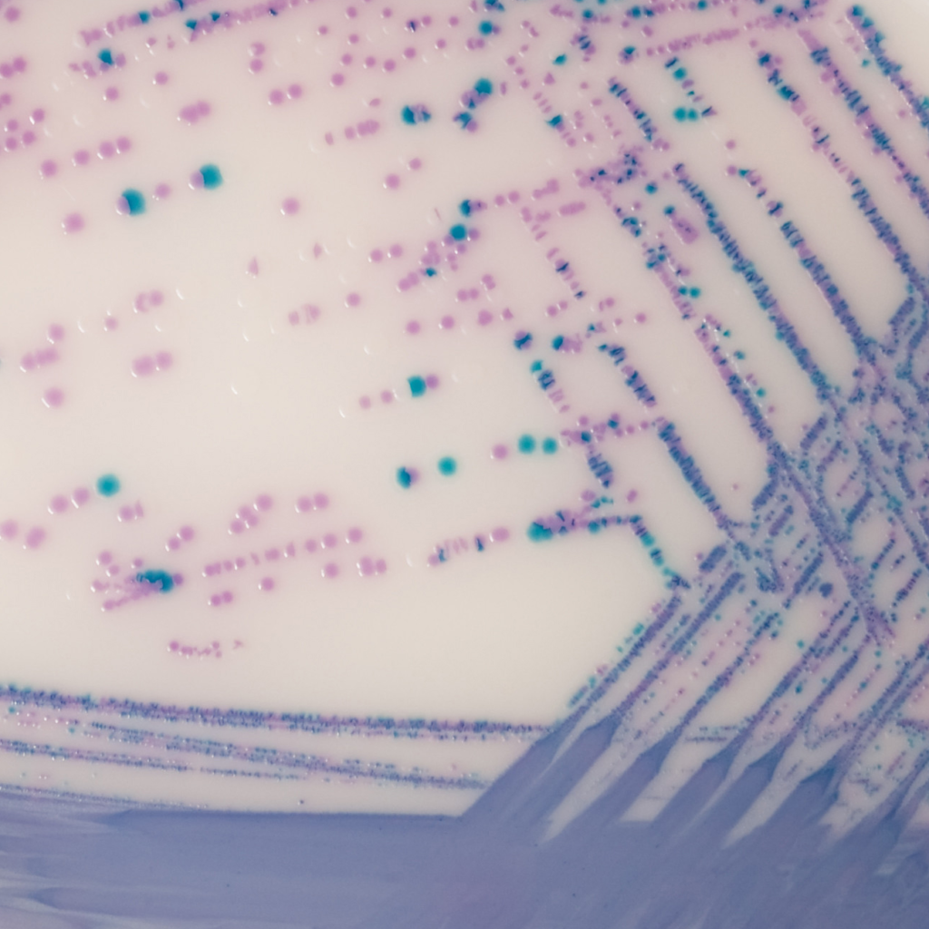 CHROMagar™ Salmonella Plus - Chromagar