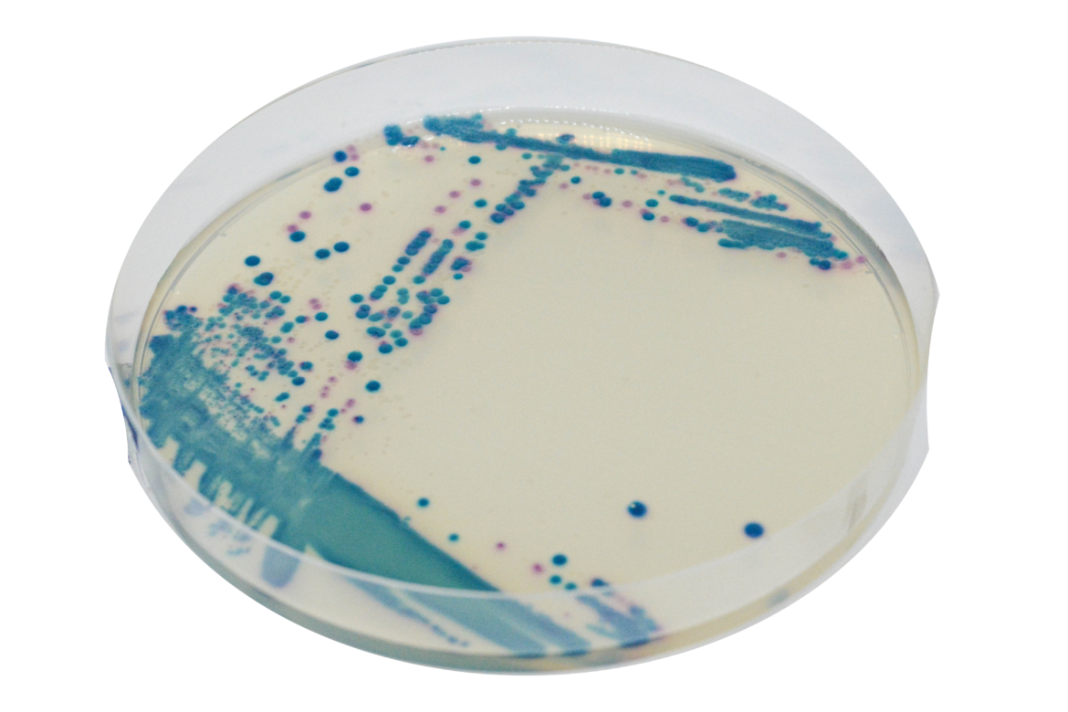 CHROMagar™ ESBL - Chromagar