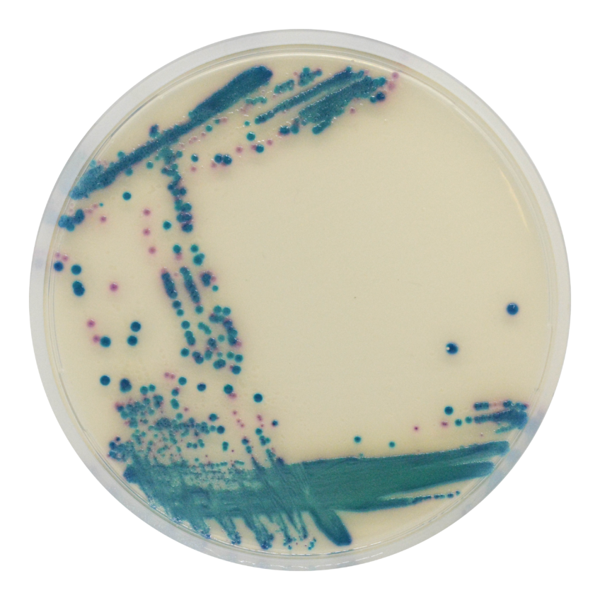 CHROMagar™ ESBL - Chromagar