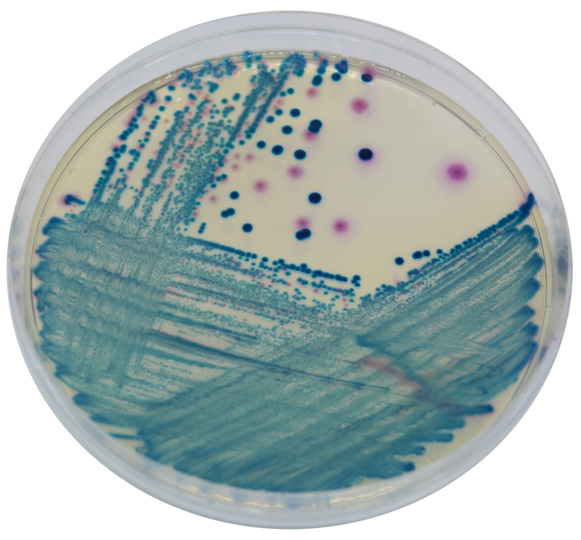 CHROMagar™ mSuperCARBA™ - Chromagar