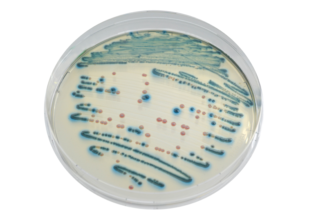 CHROMagar™ Enterobacteria - Chromagar