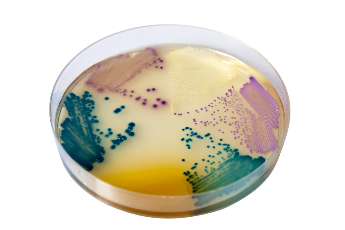 CHROMagar™ Orientation - Chromagar