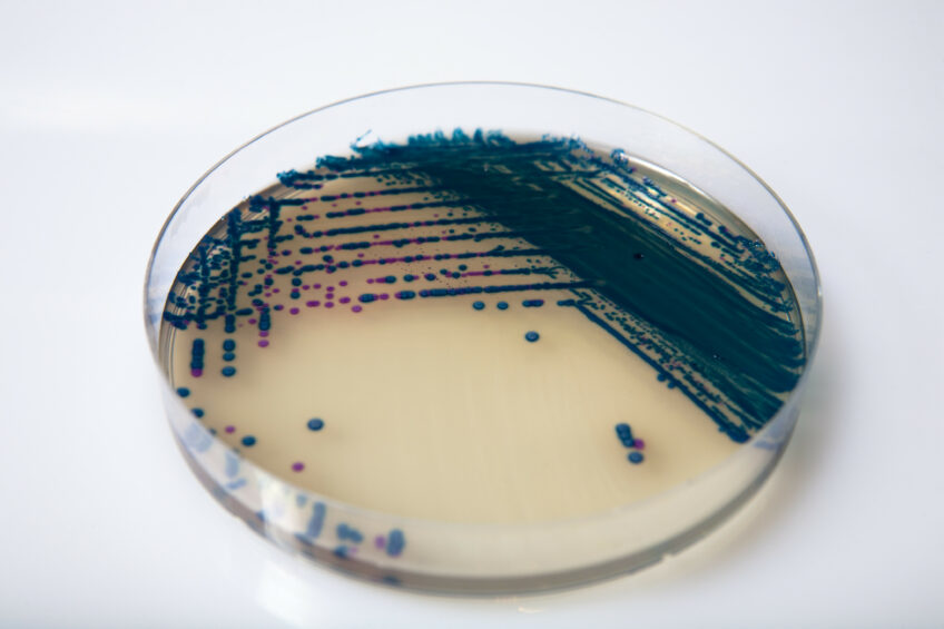 CHROMagar™ StrepB - Chromagar