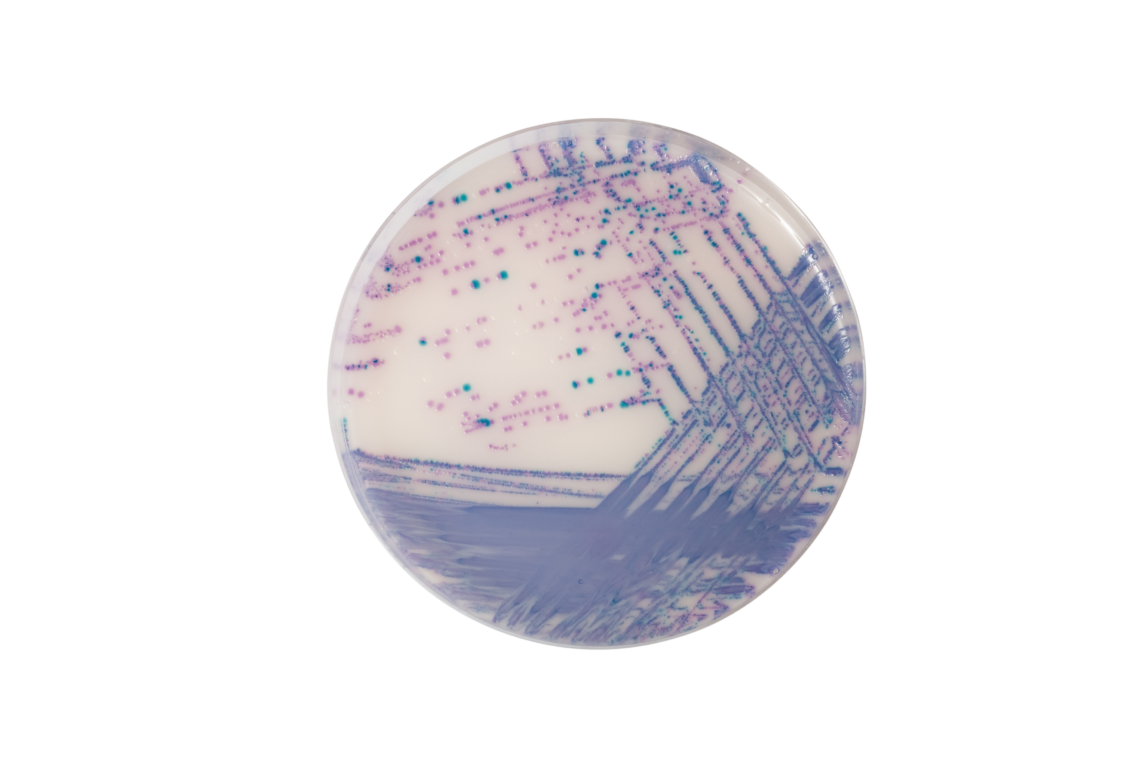 CHROMagar™ Salmonella Plus - Chromagar