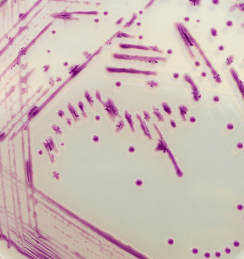 Chromagar | La plus large gamme de milieux chromogènes