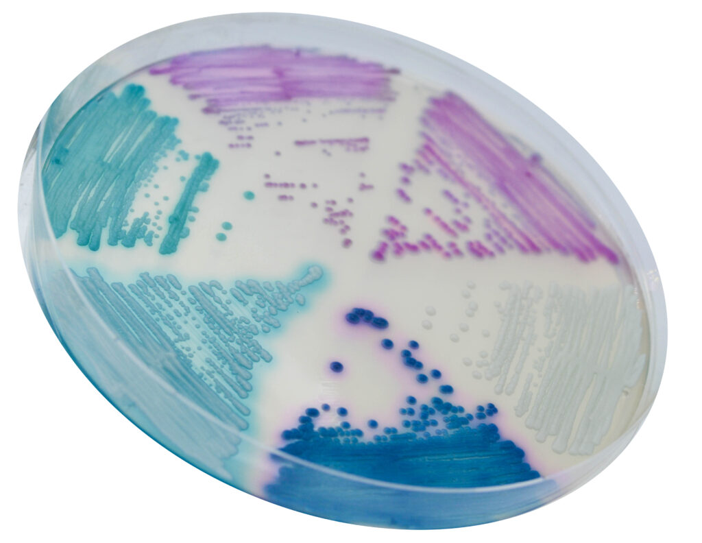CHROMagar™ Candida Plus – Chromagar