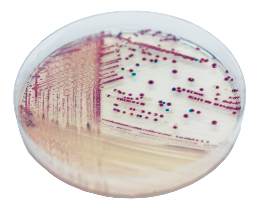 CHROMagar™ Vibrio – Chromagar