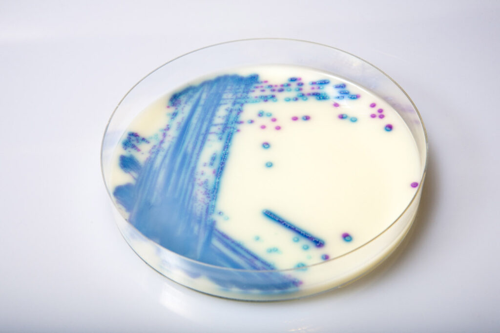 CHROMagar™ VRE – Chromagar