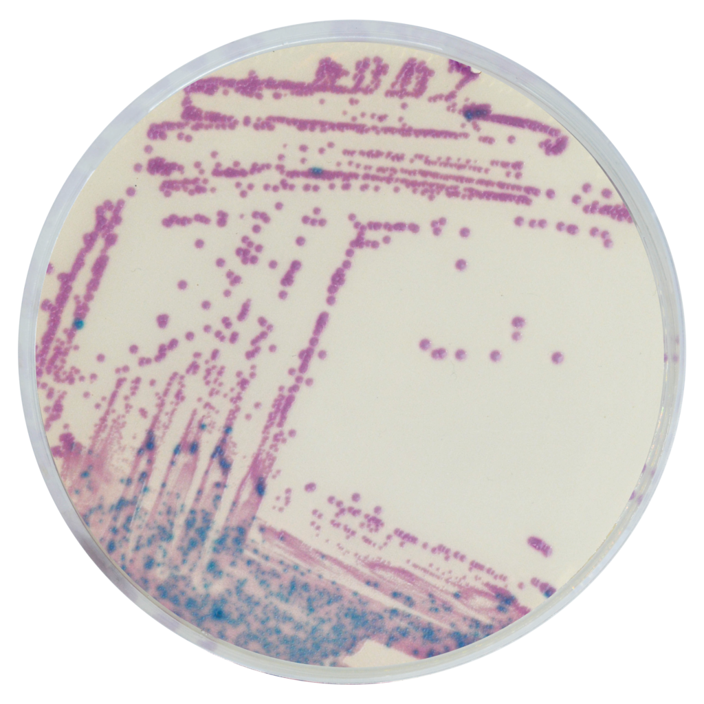 LIM RambaQUICK™ StrepB - Chromagar