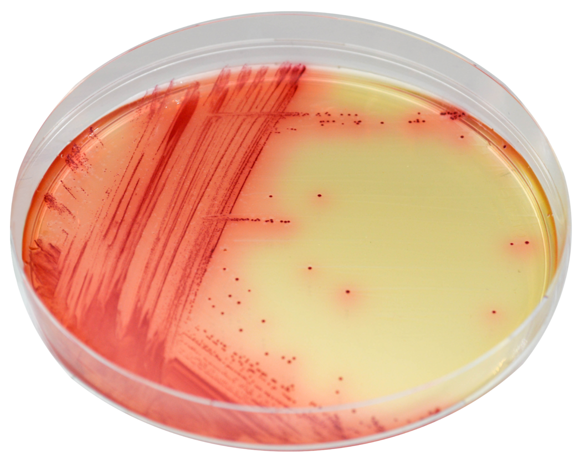 CHROMagar™ Mycoplasma – Chromagar