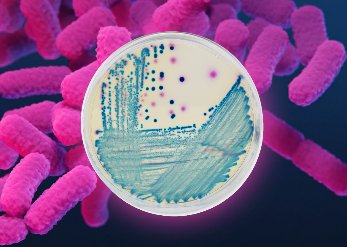 CHROMagar l The widest range of Chromogenic Media