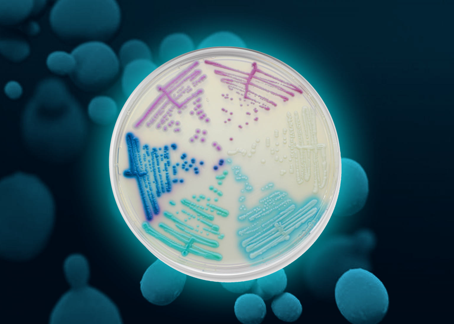Chromagar | La plus large gamme de milieux chromogènes